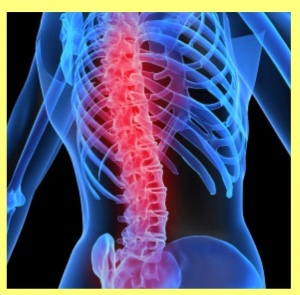 When Do You Need Surgery for Multilevel Spondylosis?